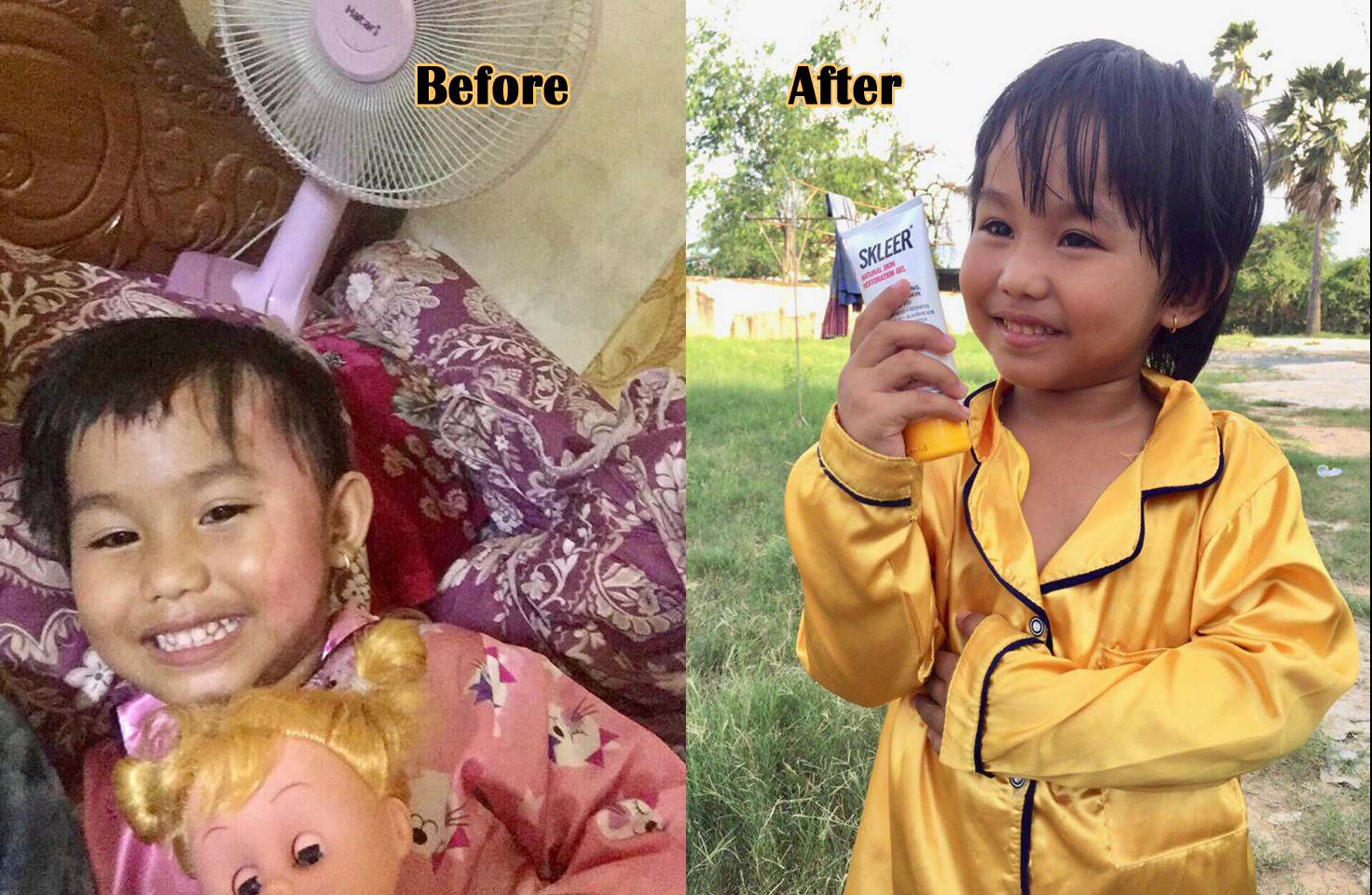 Natural first aid for Burns, Cuts & Abrasions - SKLEER